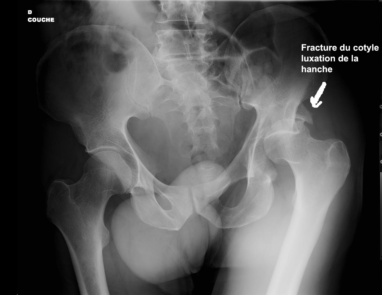 Φωτιάδης Ηλίας - Ορθοπαιδικός Χειρουργός